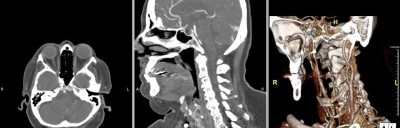 CT | Summit Radiology